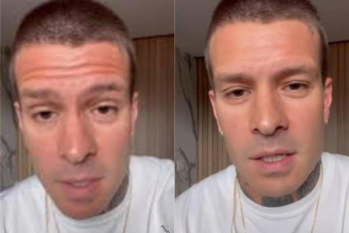 Mateus Verdelho sofre problema nos olhos por substância rara; saiba ...