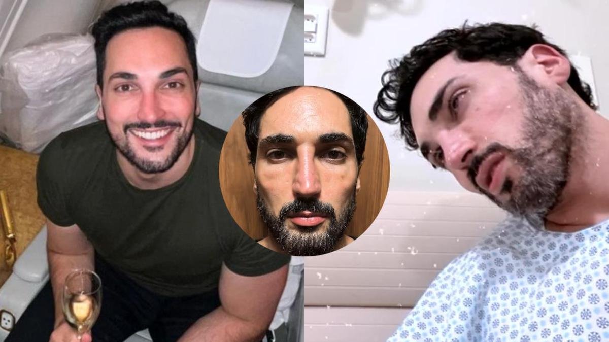 Youtuber fica com o rosto 'derretido' após usar Mounjaro e faz alerta ...