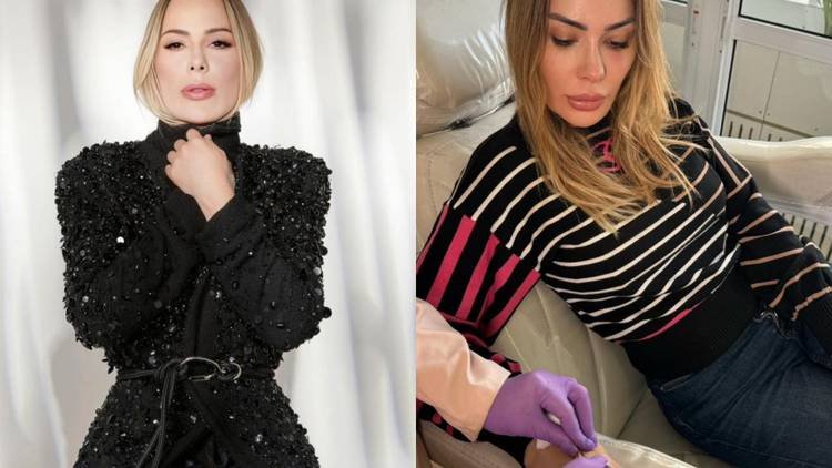 Influencer aplica harmonização nas mãos e revela motivo por trás da ...