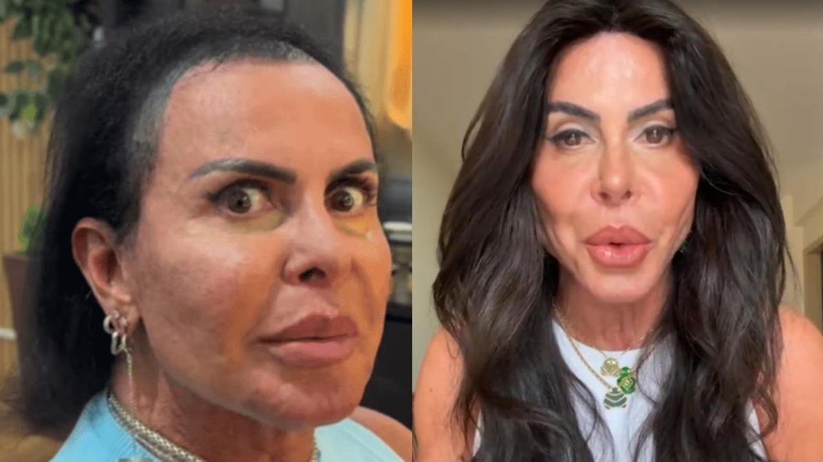 Gretchen faz relato chocante sobre doença e afirma: 'Não tenho mais ...