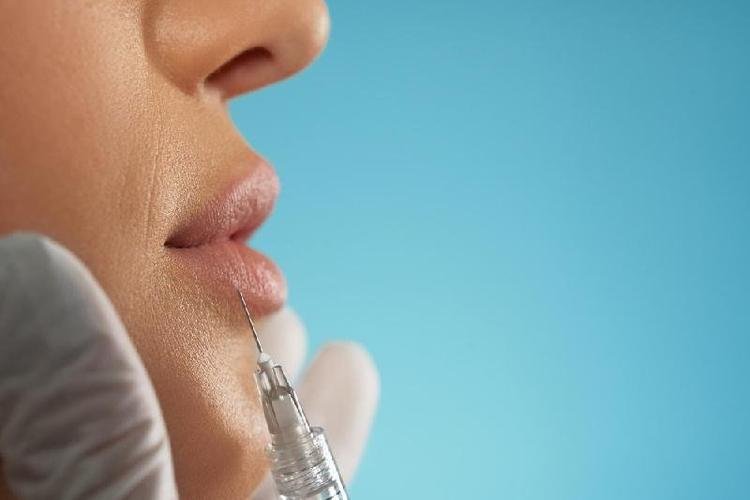 Técnica Safe Lips reduz riscos no preenchimento labial | Mundo ...