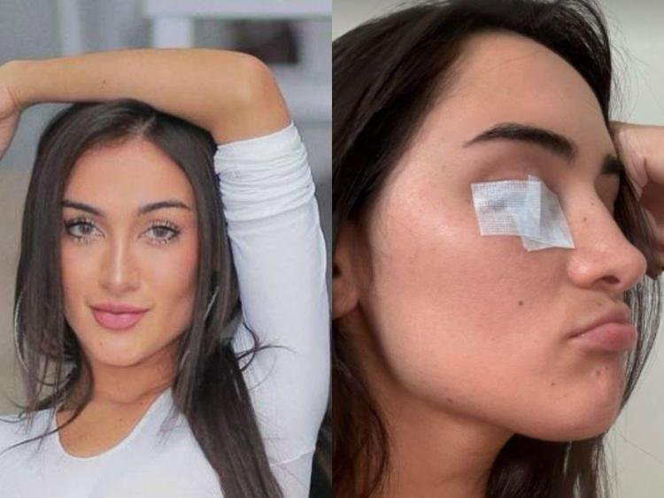 Gabi Melim é diagnosticada com doença que paralisa o rosto: 'Não mexe ...